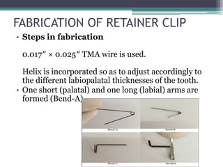 retainer clip | PPTX