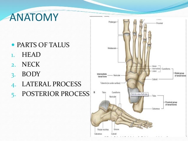 Talar Fracture