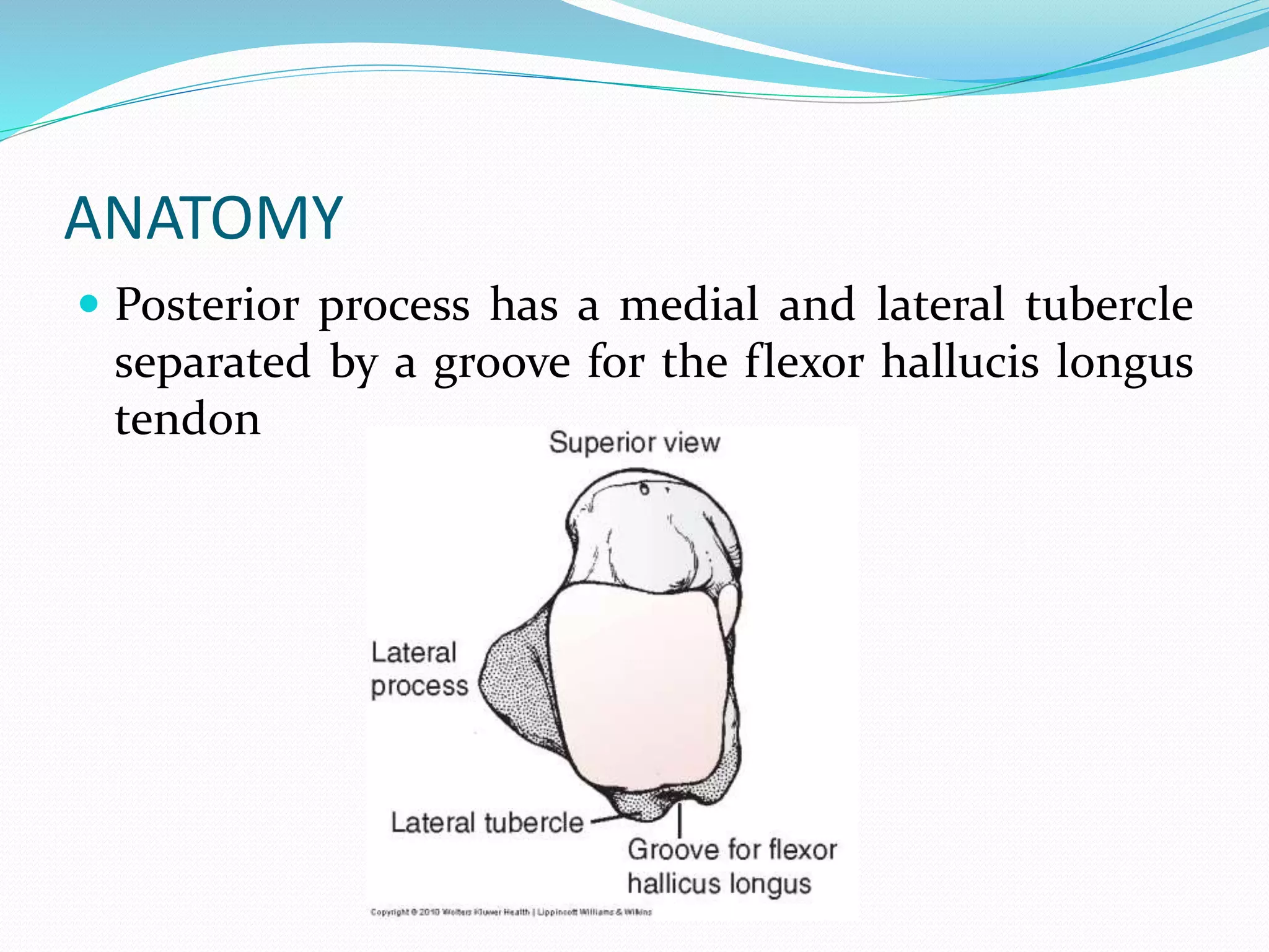 talus fracture | PPTX