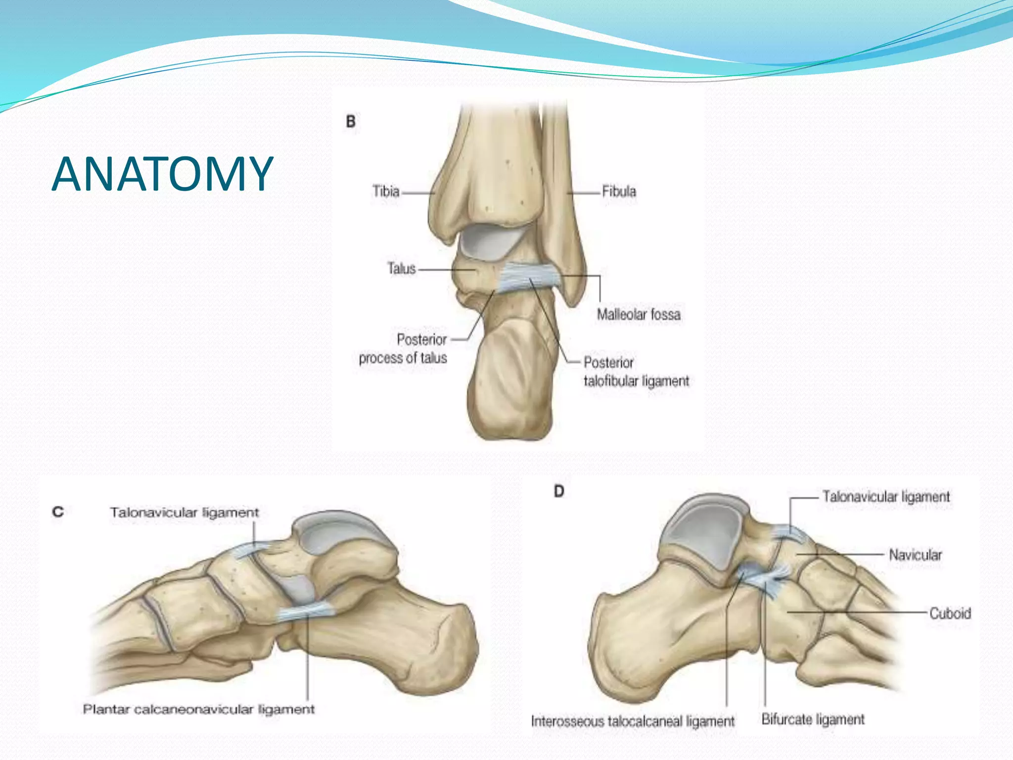 talus fracture | PPTX
