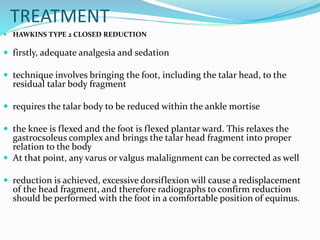 talus fracture | PPTX