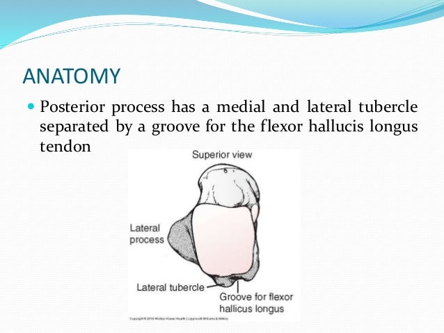 Medial Tubercle Of The Talus