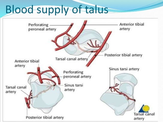 talus fracture