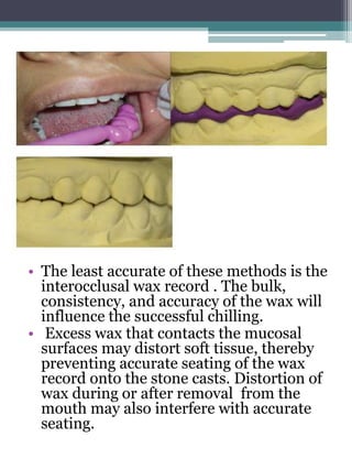 JAW RELATIONS IN CAST PARTIAL DENTURE | PPTX