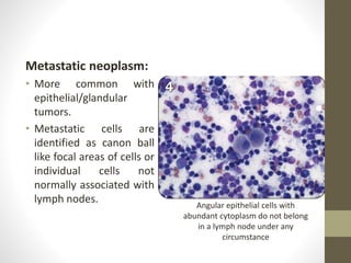 Lymph Node Impression smear cytology | PPTX