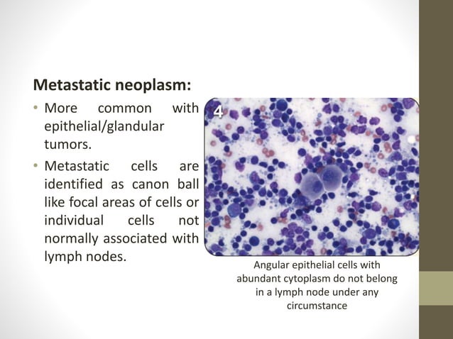 Lymph Node Impression smear cytology | PPTX | Cancer | Diseases and ...