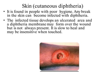 DEPHTHERIA health condition mainly seen in children | PPTX | Ear, Nose ...