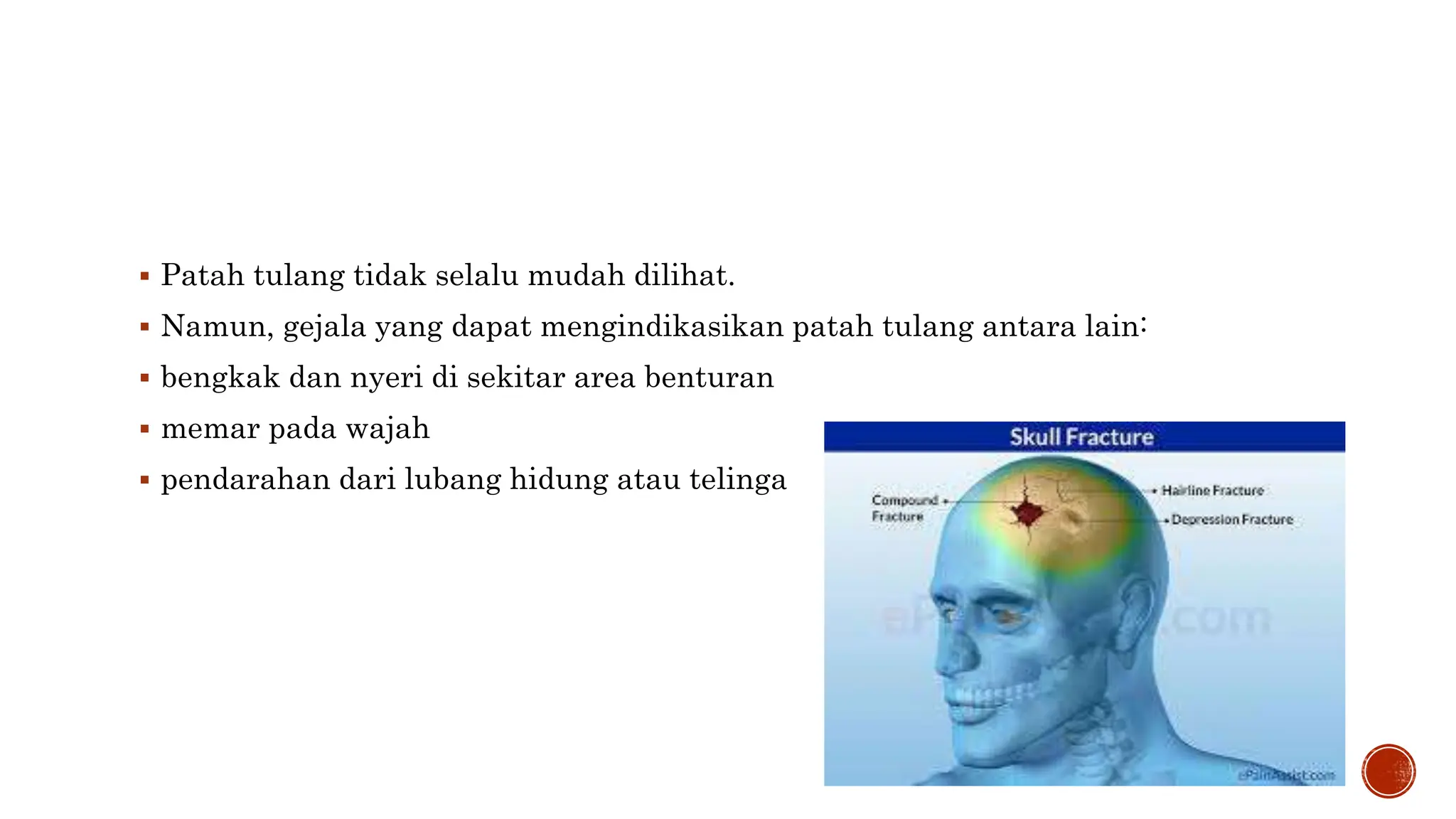 Depressed Fracture of the skull in trauma.pptx