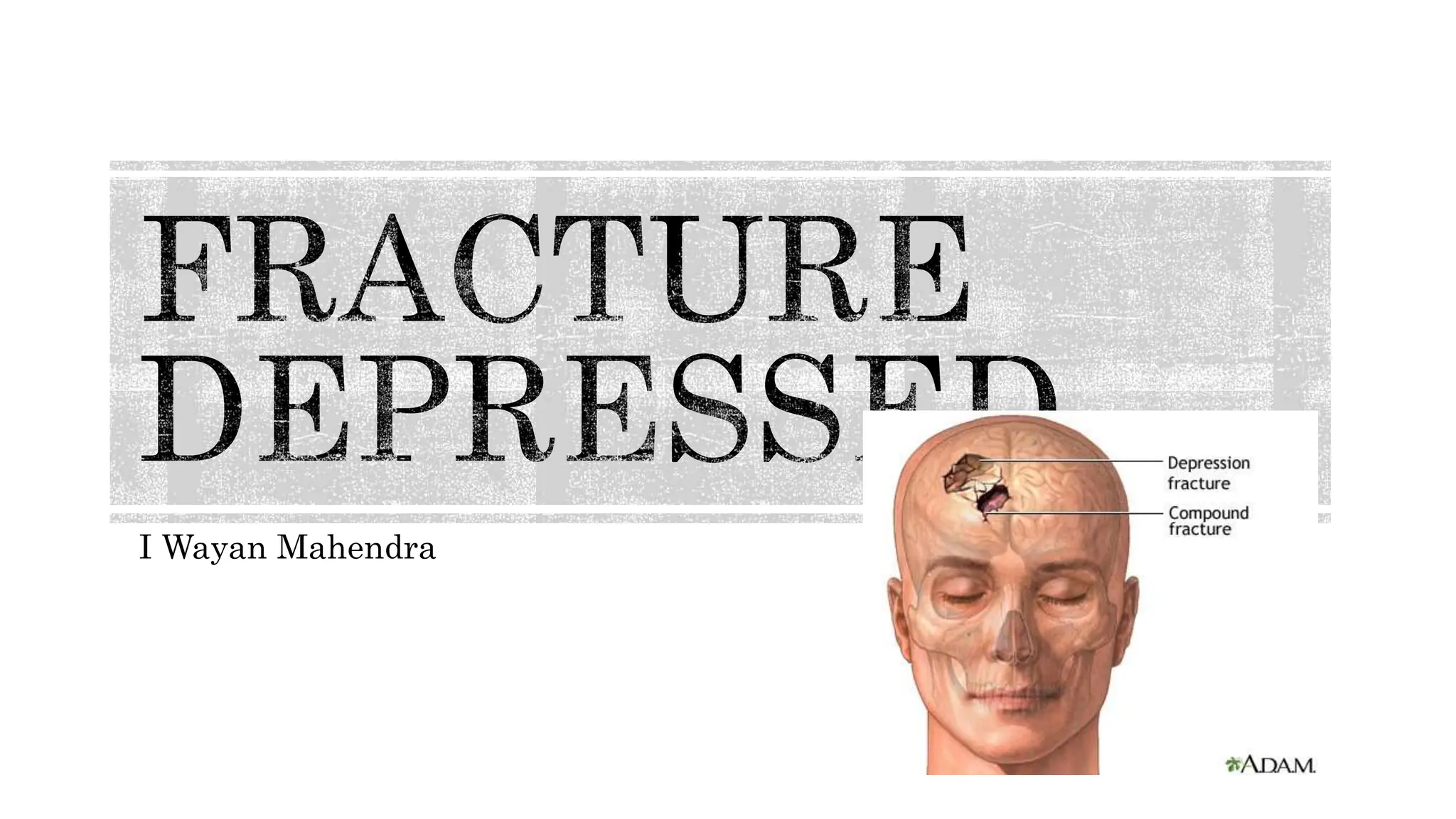 Depressed Fracture of the skull in trauma.pptx