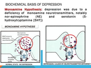 Depression | PPT