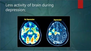 Depression | PPTX