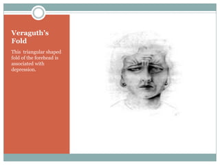 Depressiononline | PPTX