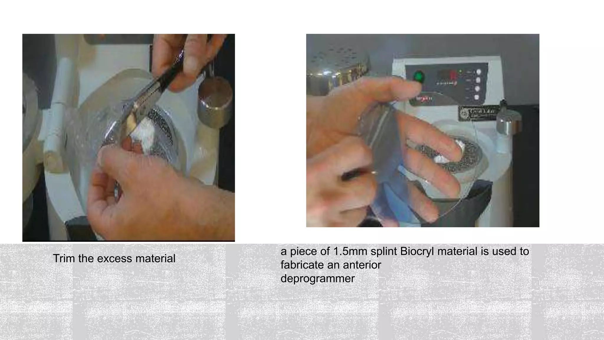 Deprogramming spilnt 1 | PPTX