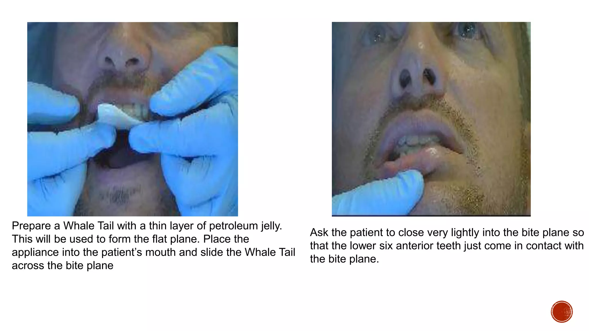 Deprogramming spilnt 1 | PPTX