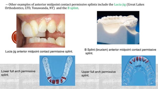 Deprogramming spilnt 1 | PPTX | Dental Health | Diseases and Conditions