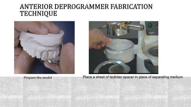 Deprogramming spilnt 1 | PPTX | Dental Health | Diseases and Conditions