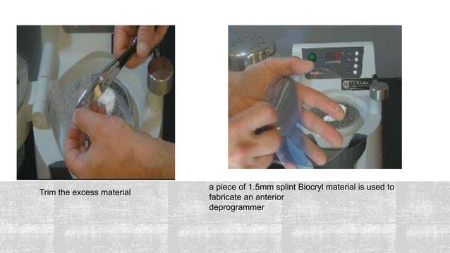 Deprogramming spilnt 1 | PPTX | Dental Health | Diseases and Conditions