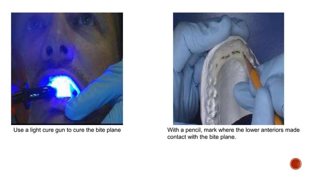 Deprogramming spilnt 1 | PPTX | Dental Health | Diseases and Conditions