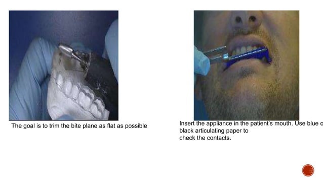 Deprogramming spilnt 1 | PPTX | Dental Health | Diseases and Conditions