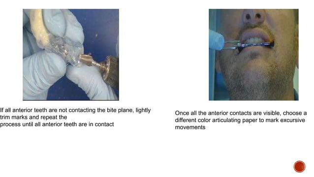 Deprogramming spilnt 1 | PPTX | Dental Health | Diseases and Conditions