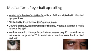 Depth of Anesthesia and effects on ou.pptx | Eye and Vision Conditions ...