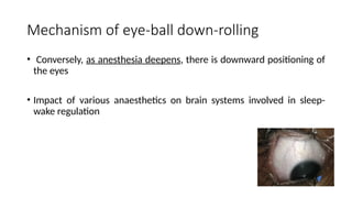 Depth of Anesthesia and effects on ou.pptx | Eye and Vision Conditions ...