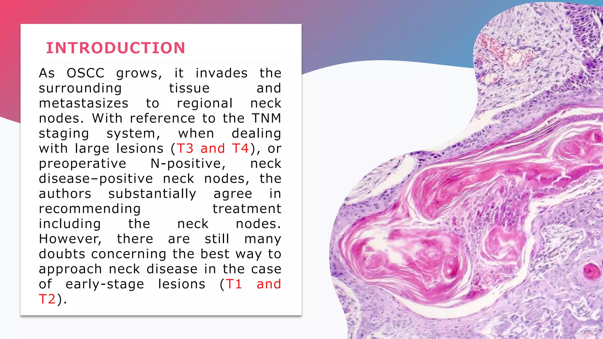 Depth of invasion in oral squamous cell carcinoma | PPTX