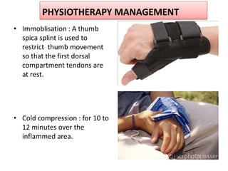 De quervain’s | PPTX