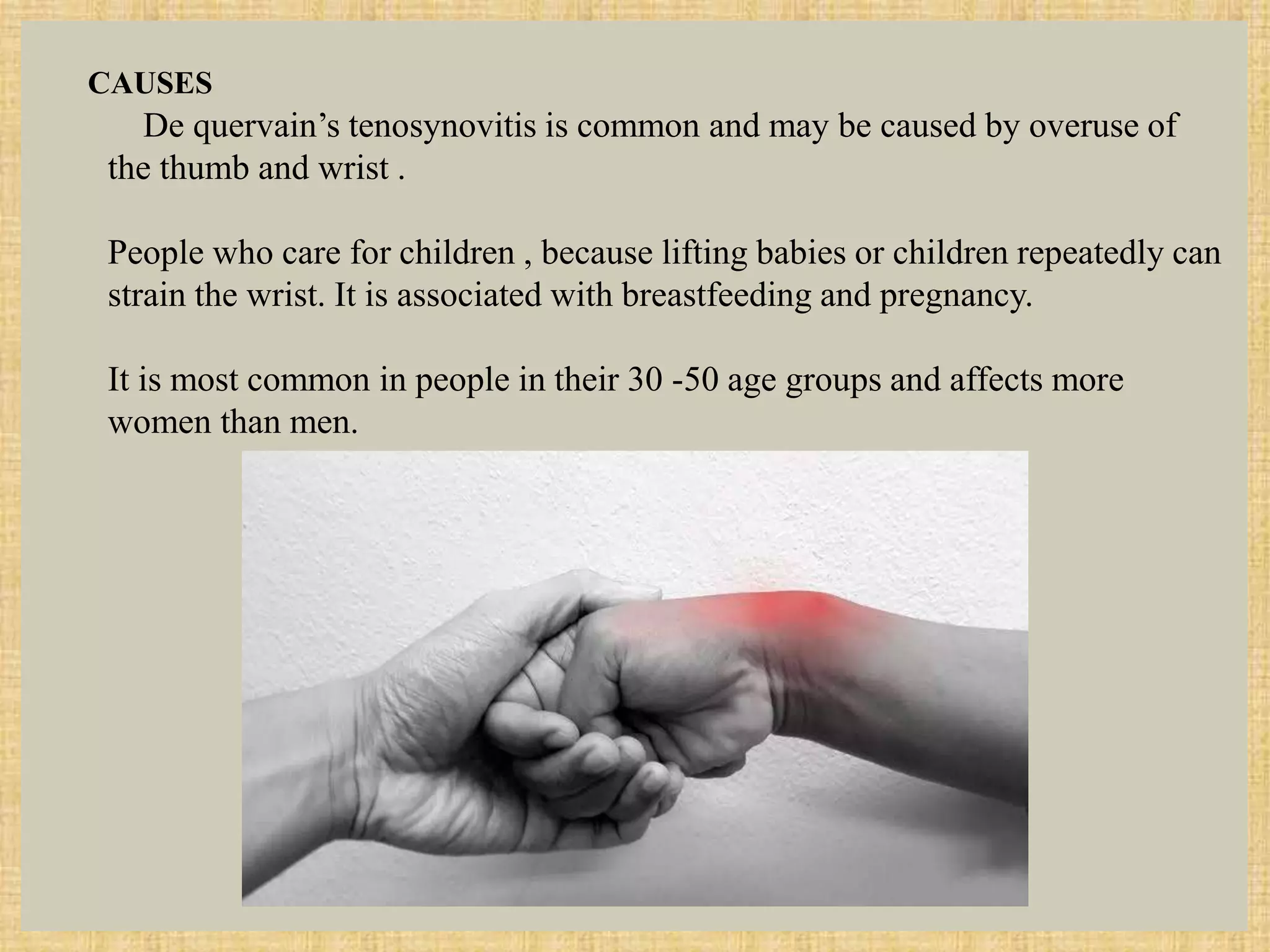 DE QUERVAIN’S TENOSYNOVITIS.pptx by Alnon LJ PHARM D INTERN | PPTX