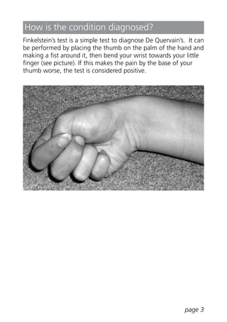 De quervain's tenosynovitis | PDF