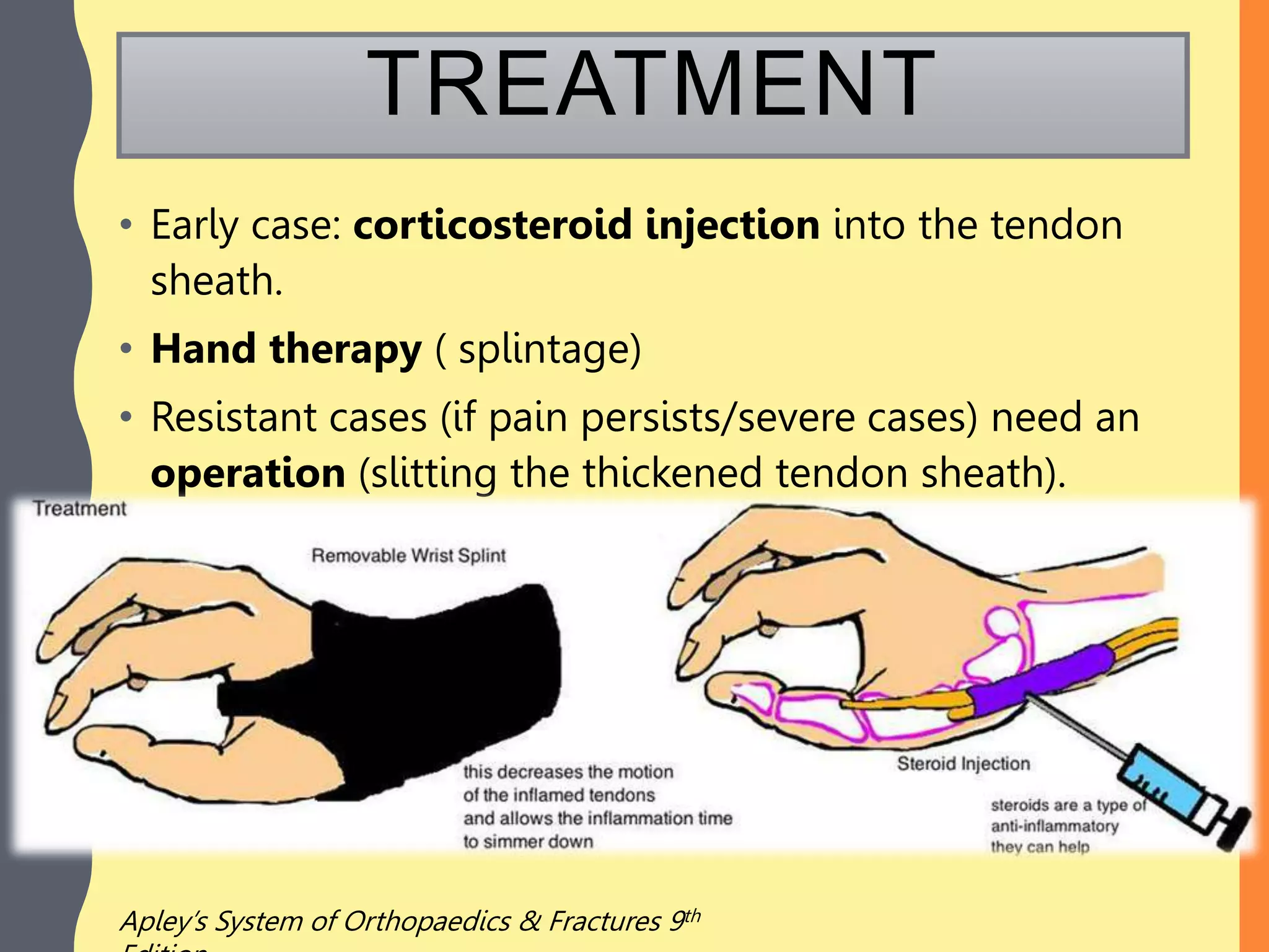 Dequervain's Tenosynovitis23.pptx