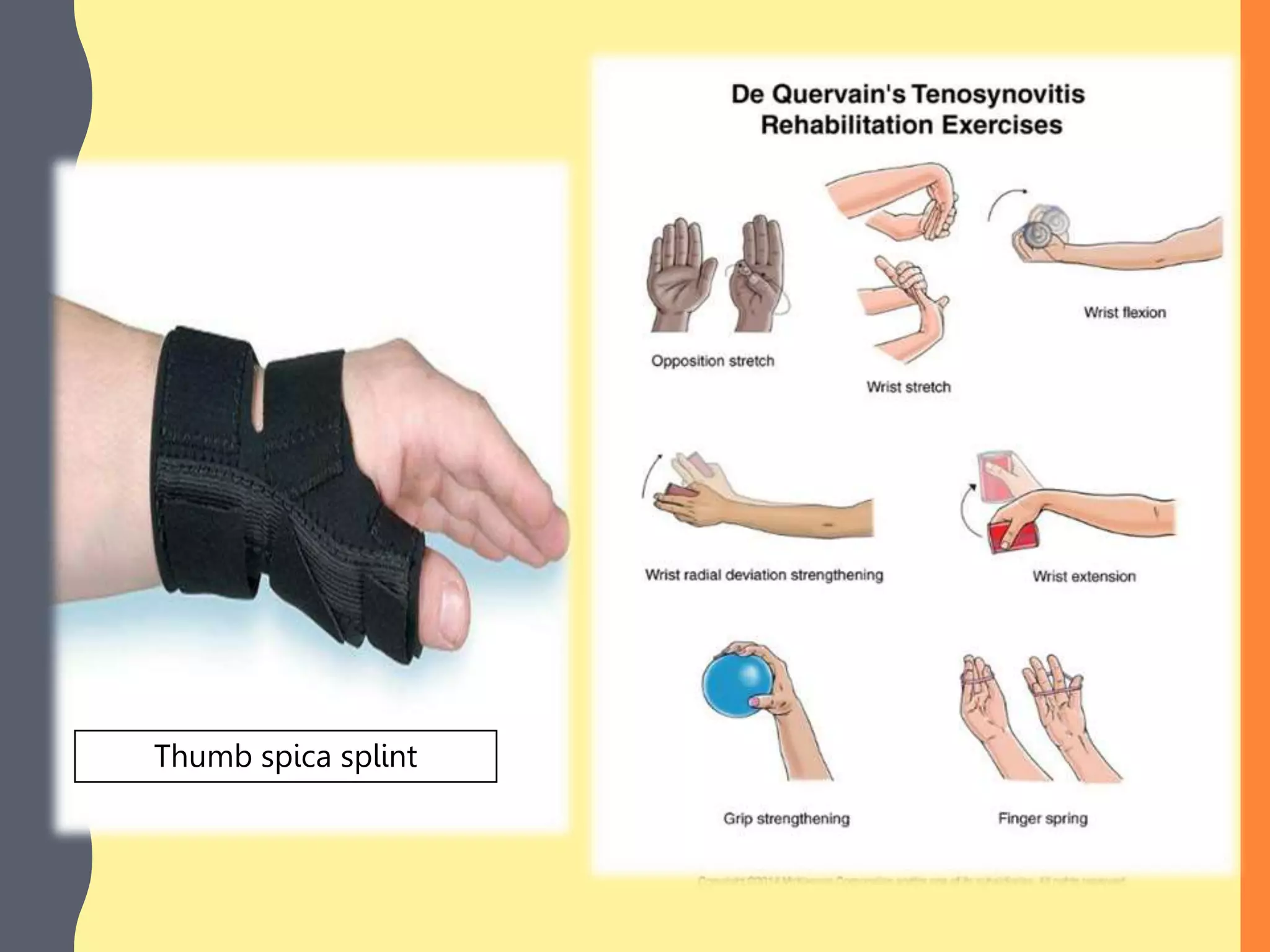 Dequervain's Tenosynovitis23.pptx