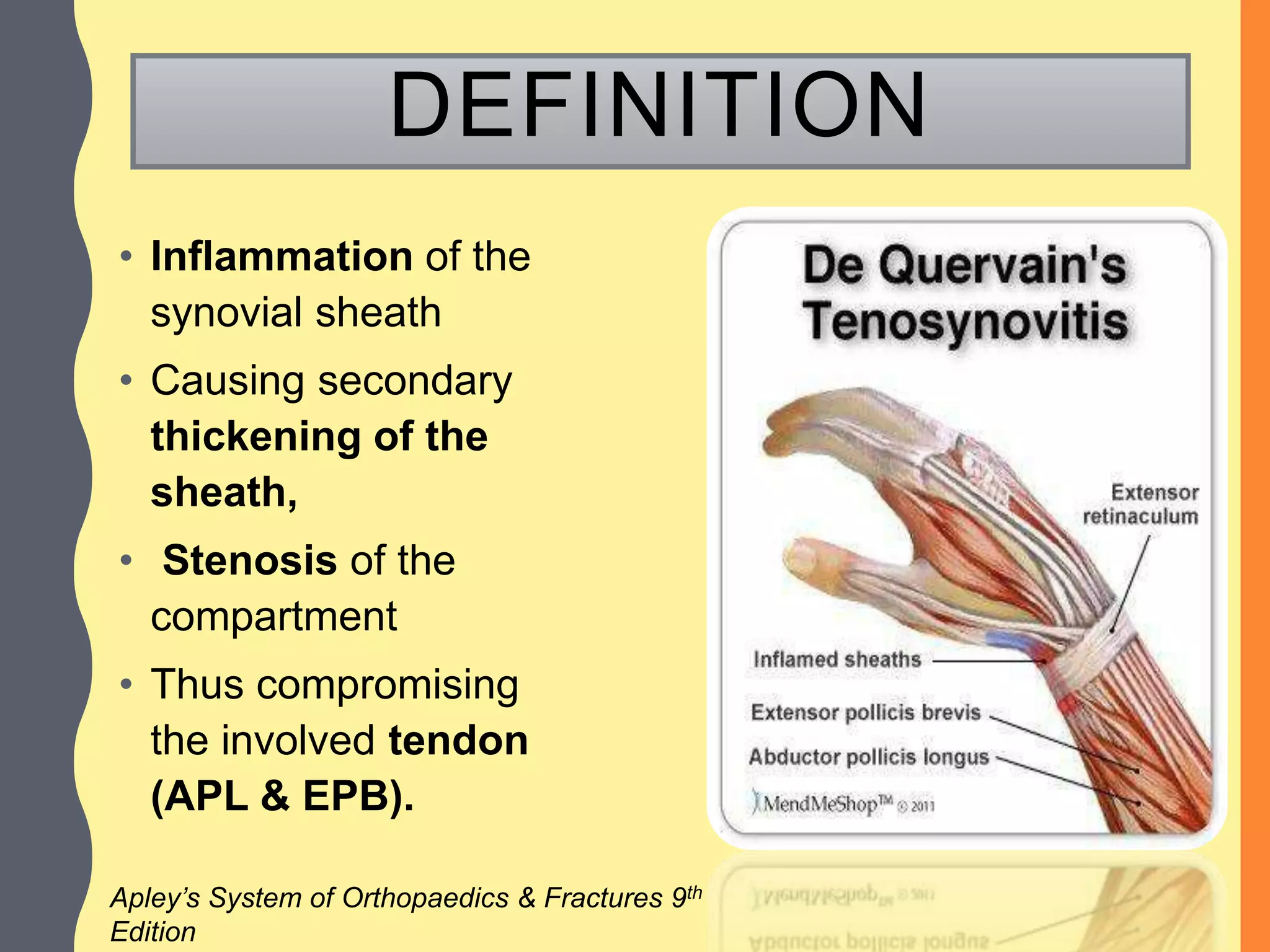 Dequervain's Tenosynovitis23.pptx