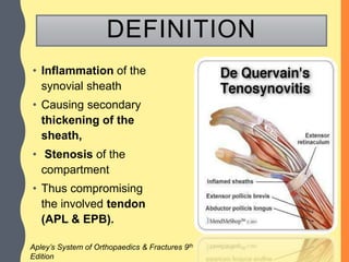 Dequervain's Tenosynovitis23.pptx