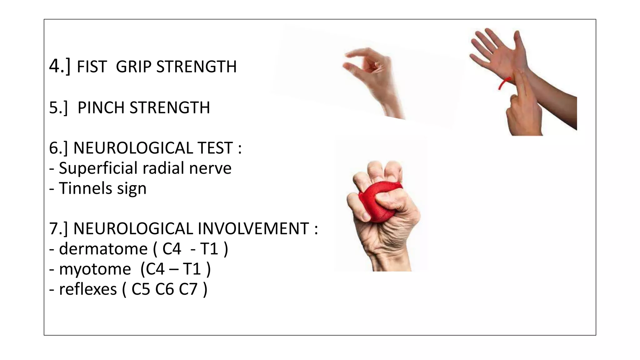 De quervain syndrome | PPTX