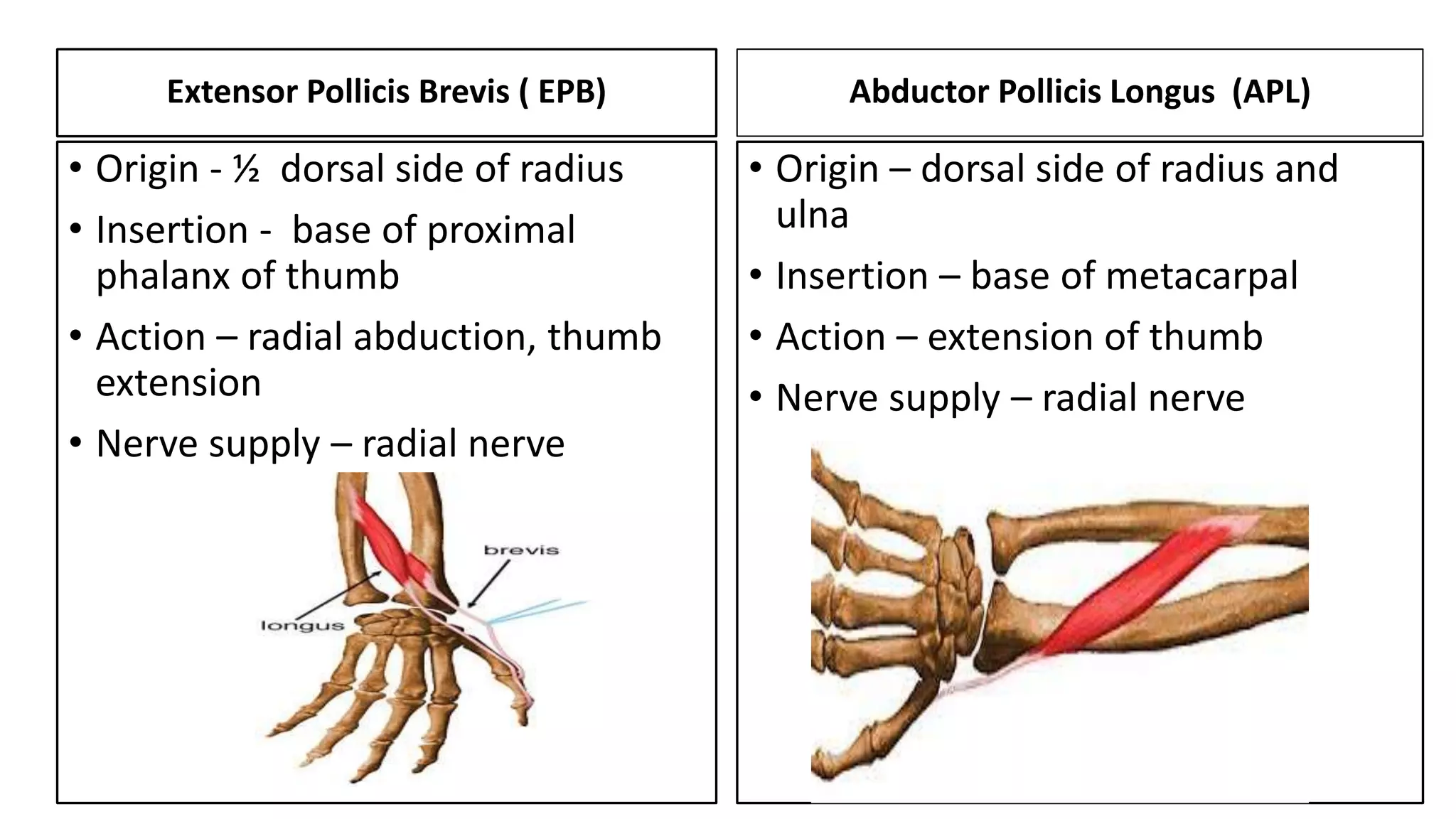 De quervain syndrome | PPTX