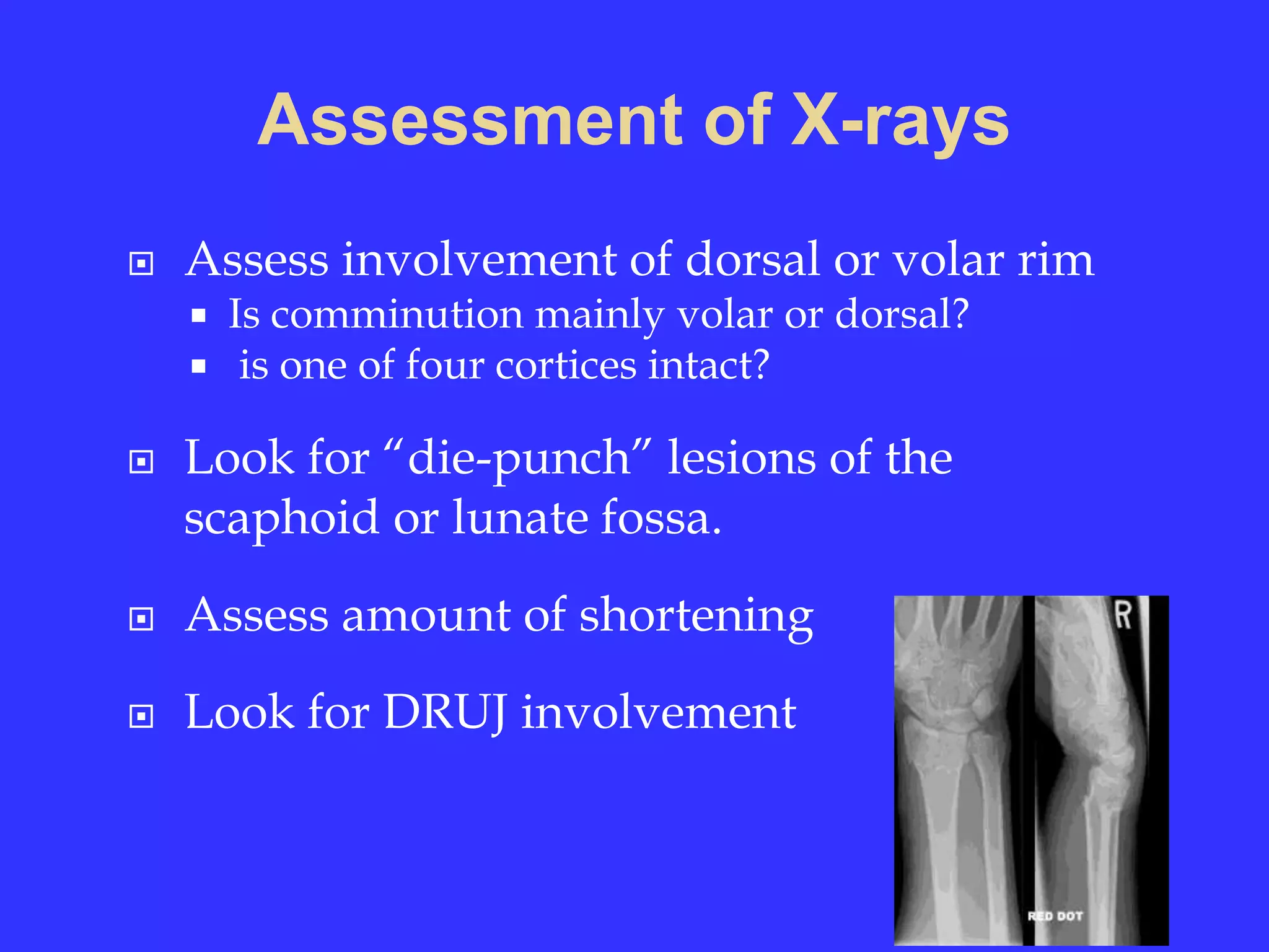 DISTAL END RADIUS FRACTURE | PPTX