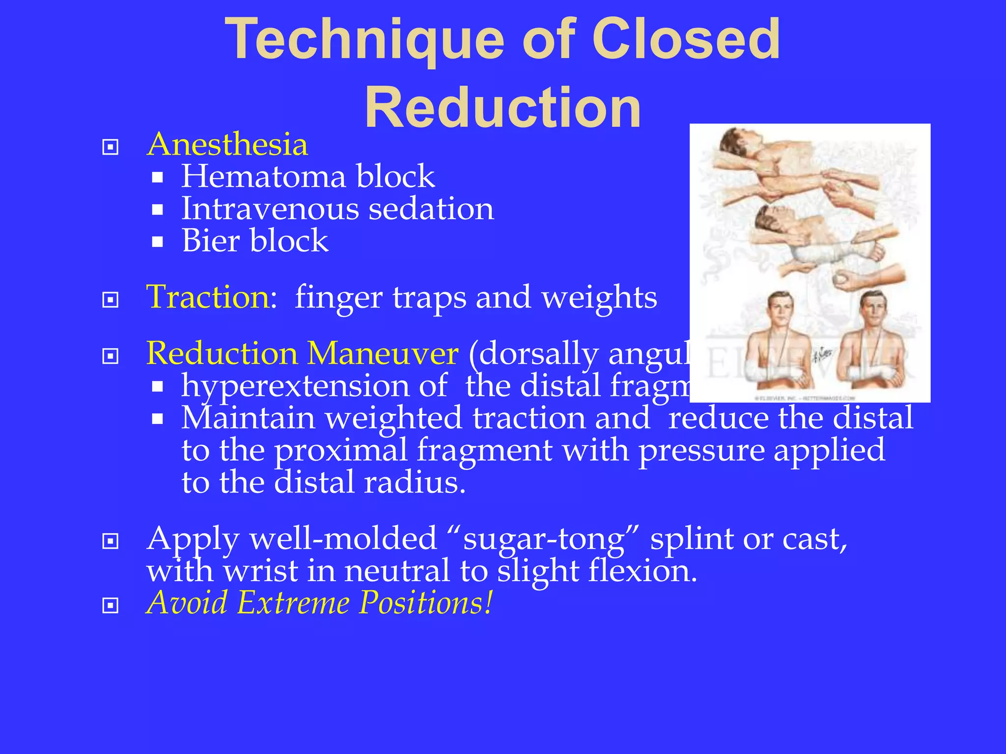DISTAL END RADIUS FRACTURE | PPTX