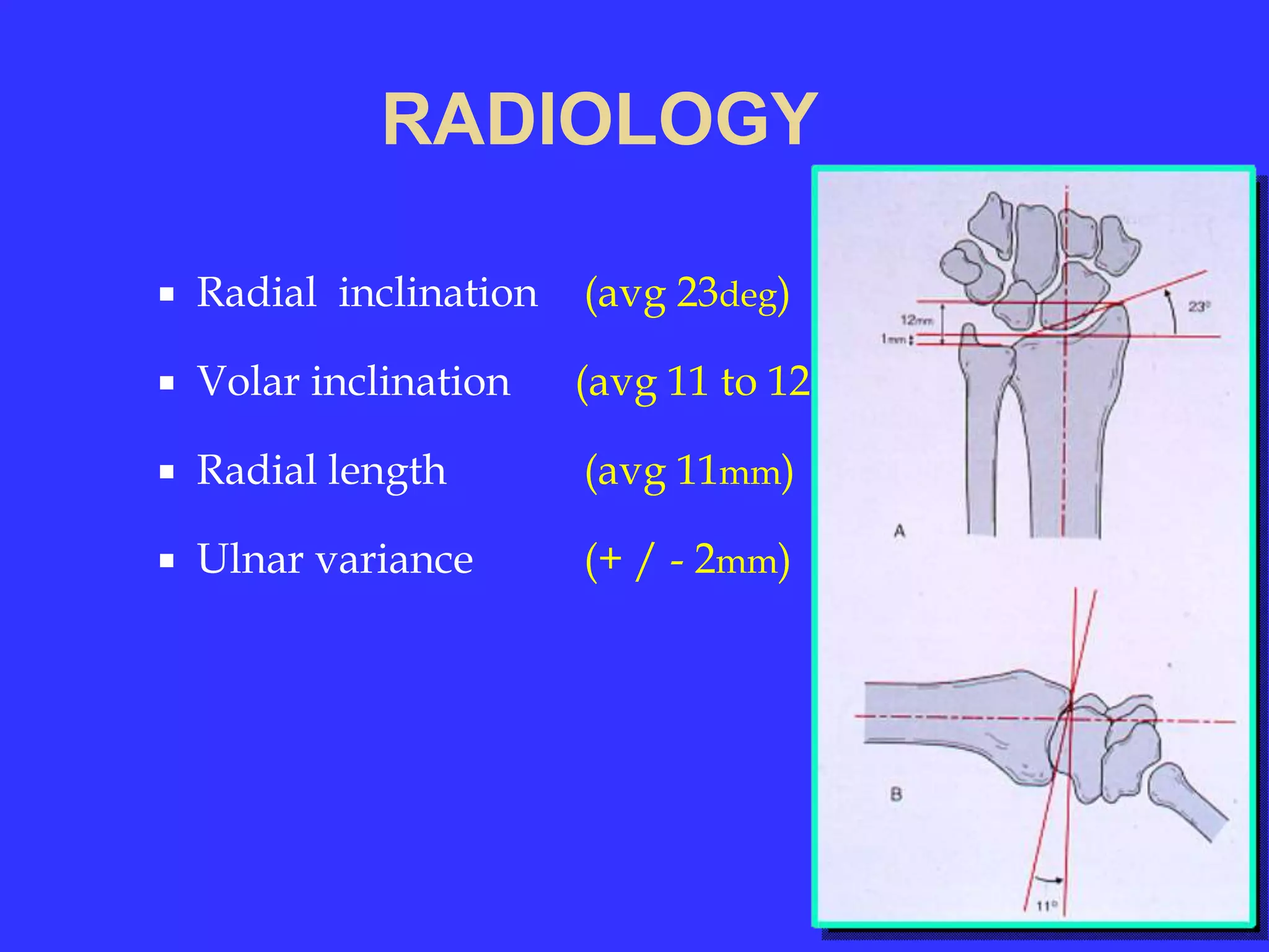 DISTAL END RADIUS FRACTURE | PPTX