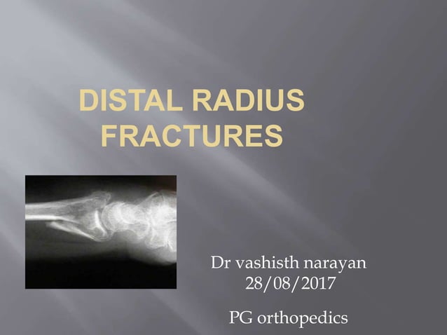 DISTAL END RADIUS FRACTURE | PPTX