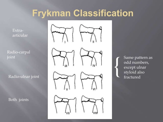 DISTAL END RADIUS FRACTURE | PPTX
