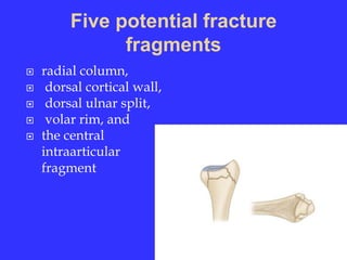 DISTAL END RADIUS FRACTURE | PPTX
