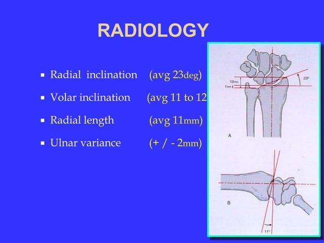 DISTAL END RADIUS FRACTURE | PPTX