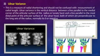 distal end radius fracture and its management | PPTX