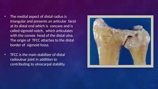 distal end radius fracture and its management | PPTX