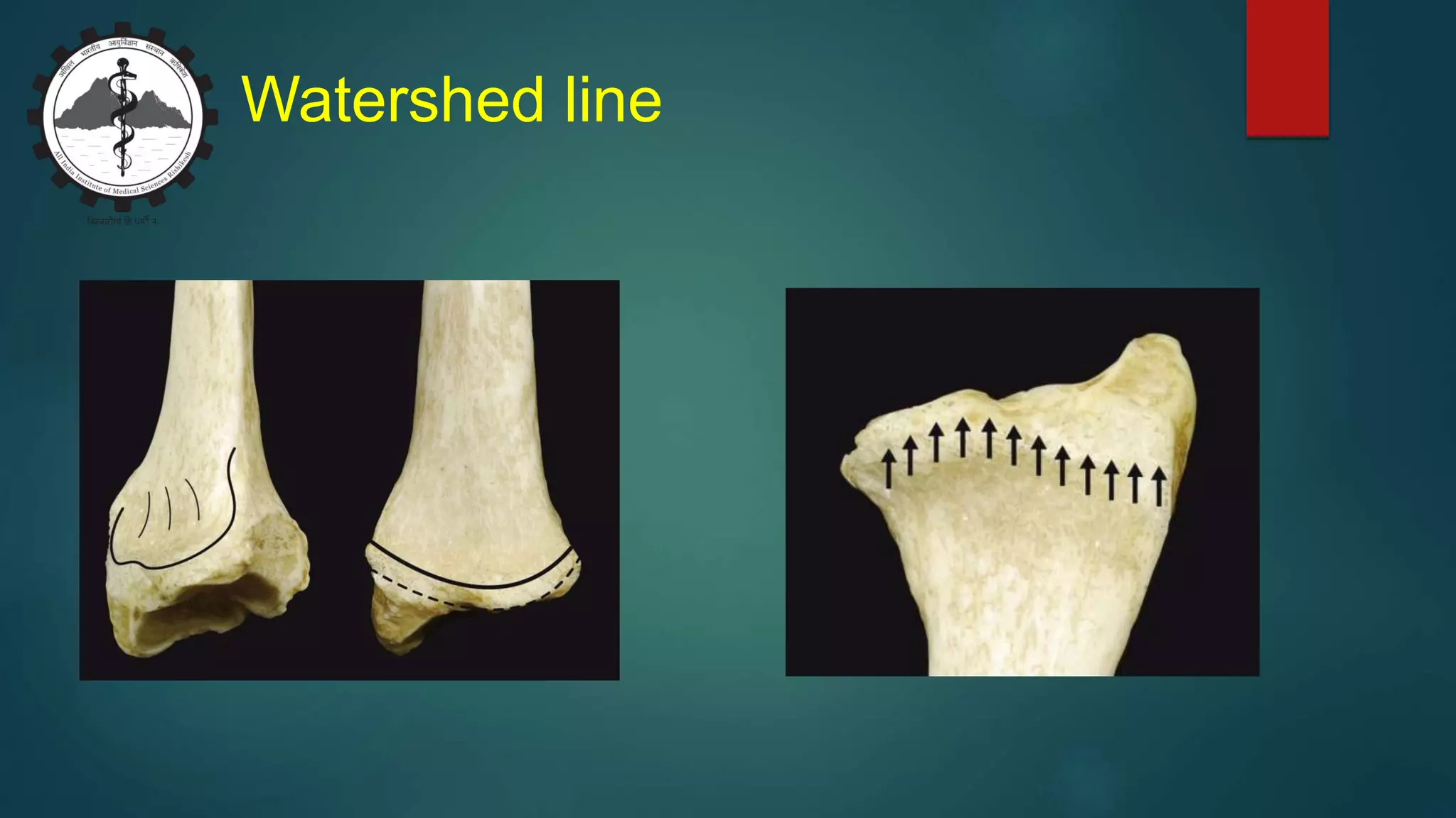 Distal radius fractures | PPTX