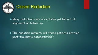 Distal radius fractures | PPTX