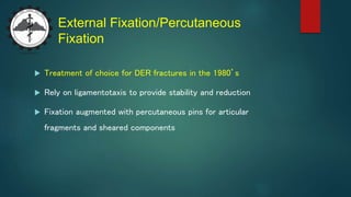 Distal radius fractures | PPTX