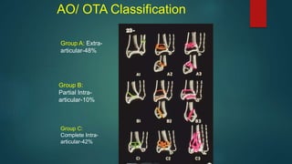 Distal radius fractures | PPTX