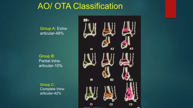 Distal radius fractures | PPTX